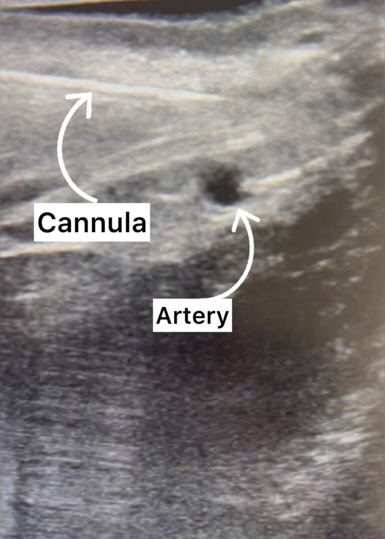 Ultrasound Guided Injections | Dr. Bita Farrell